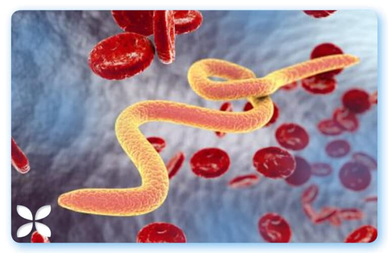 Comment se débarrasser des vers intestinaux naturellement ? - British & Co